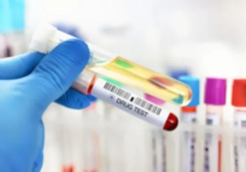 How to interpret drug test results?