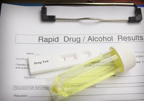 How to Master Urine Drug Test Full Service in Simple Steps?